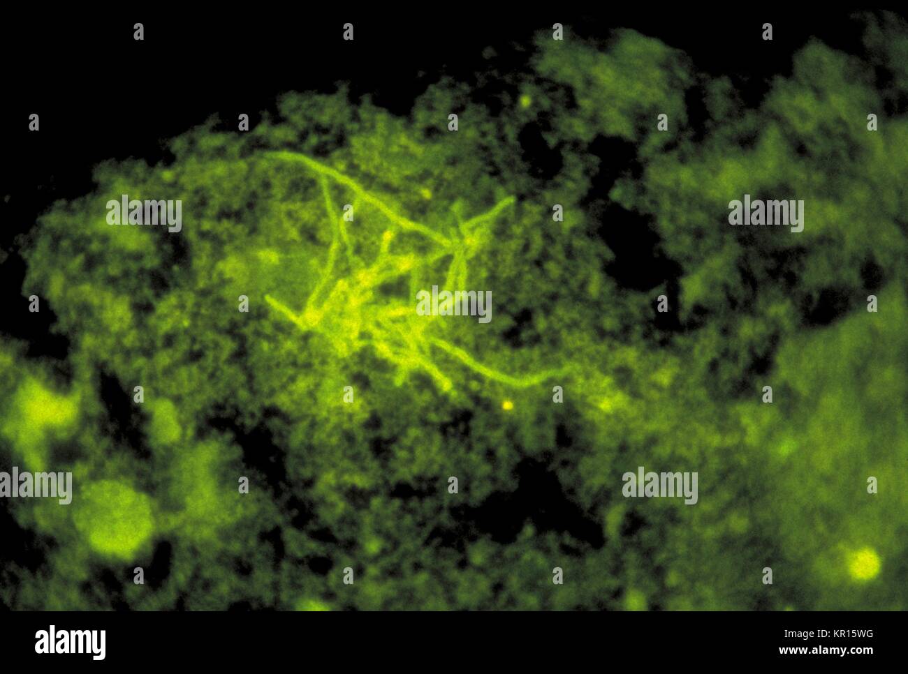 Actinomyces israelii hi-res stock photography and images - Alamy
