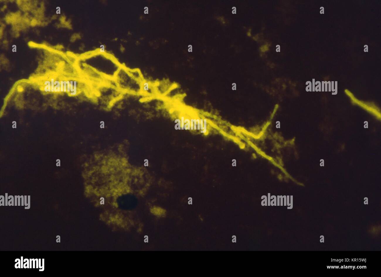 Actinomyces israelii hi-res stock photography and images - Alamy