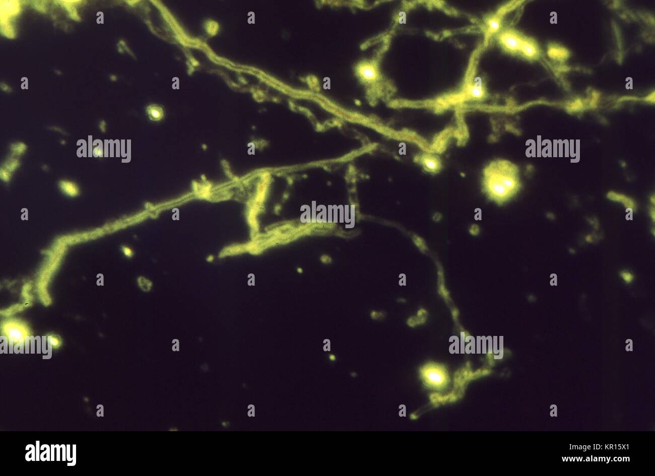 A photomicrograph of Actinomyces naeslundii using an Immunofluorescent ...