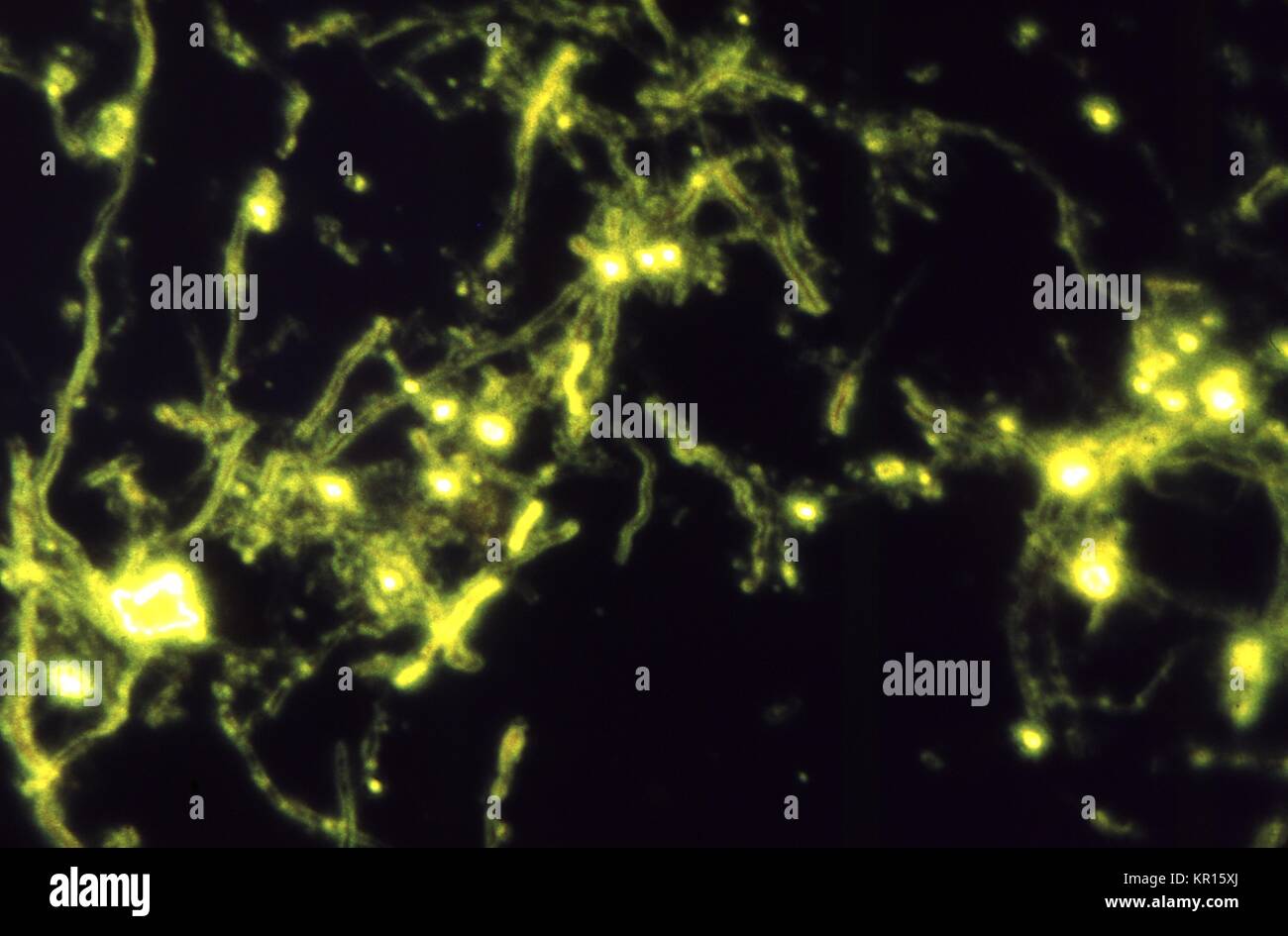 A photomicrograph of Actinomyces naeslundii using an Immunofluorescent ...