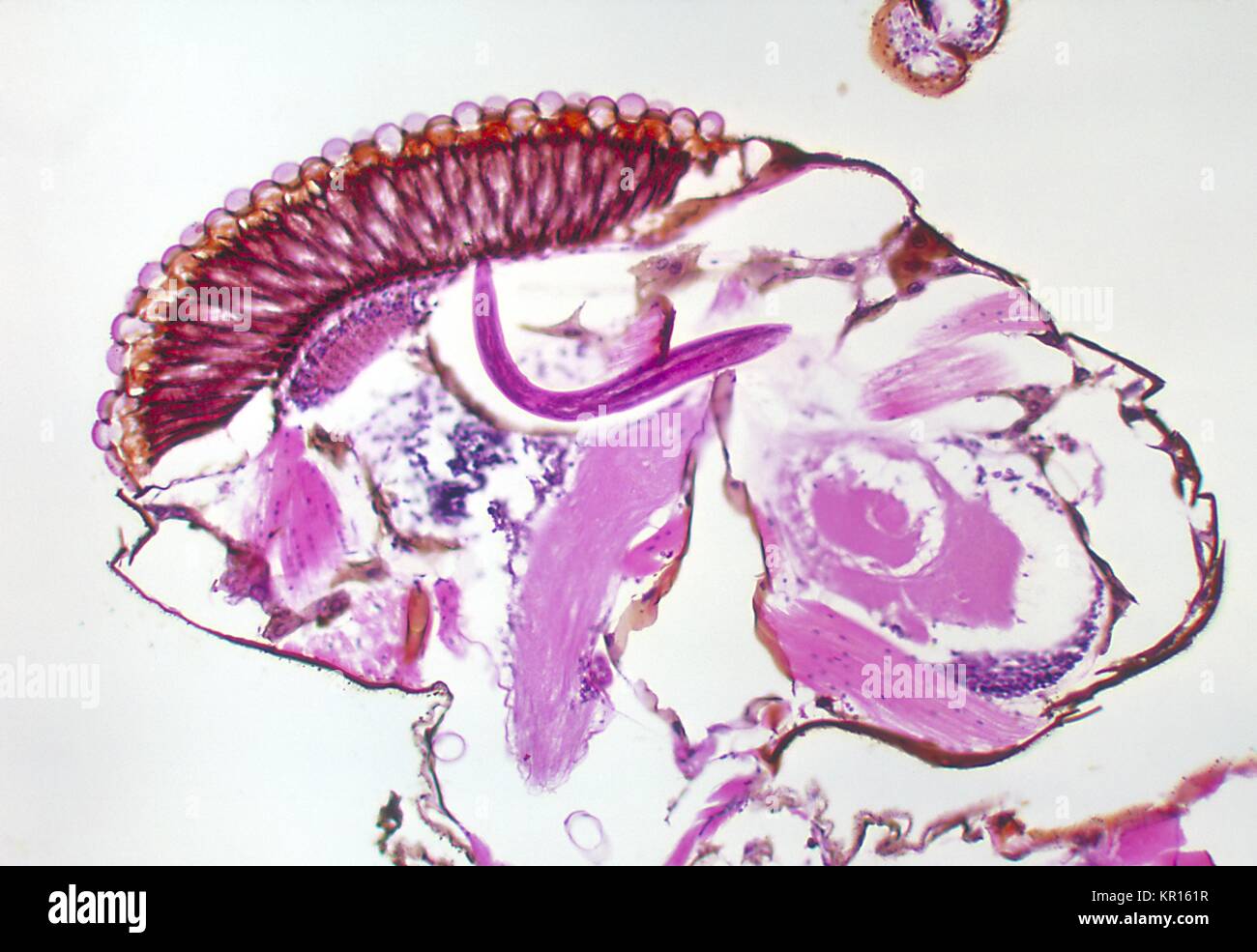 Simulium hi-res stock photography and images - Alamy