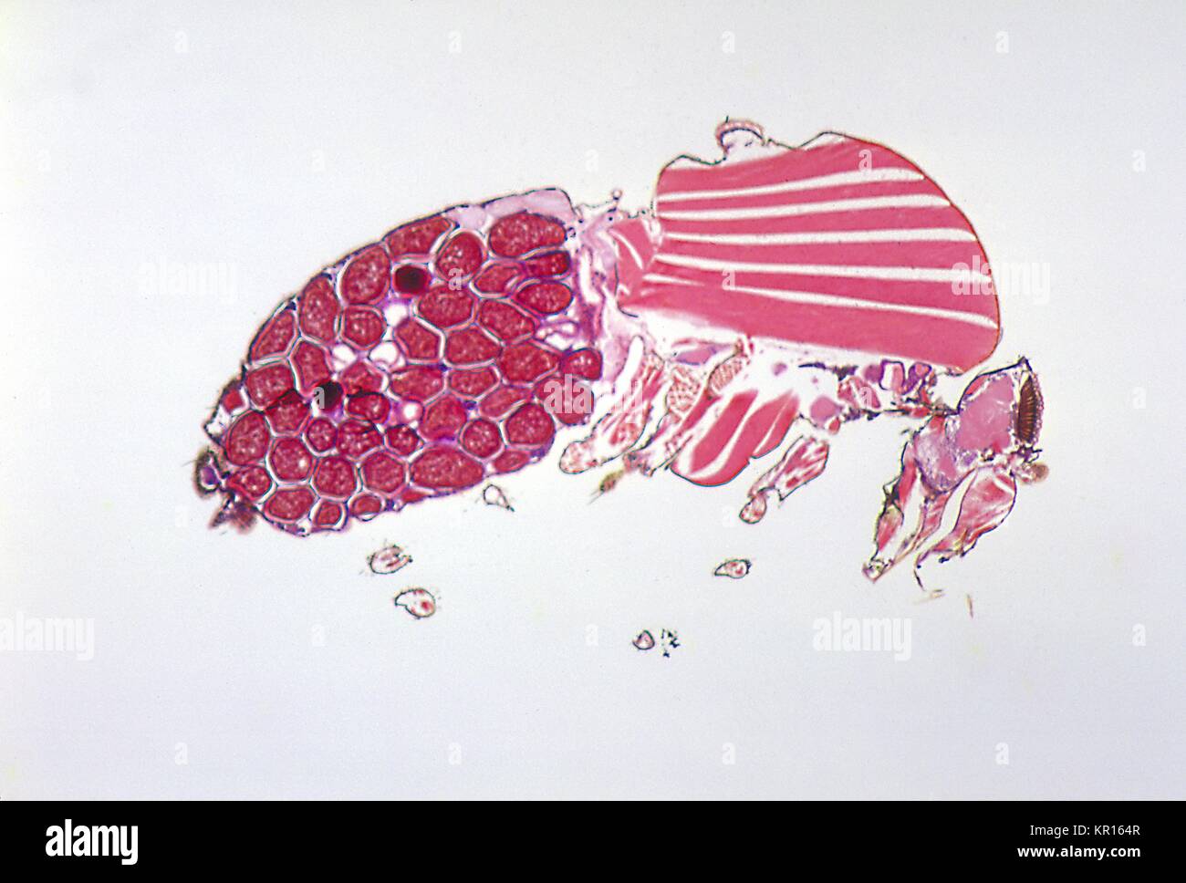 Onchocerca hi-res stock photography and images - Alamy