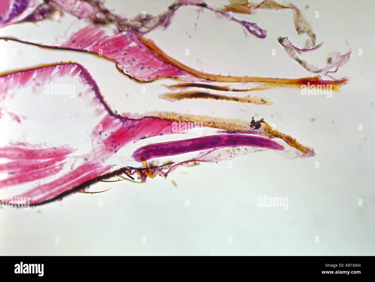 A photomicrograph revealing the histology of Onchocerca volvulus ...