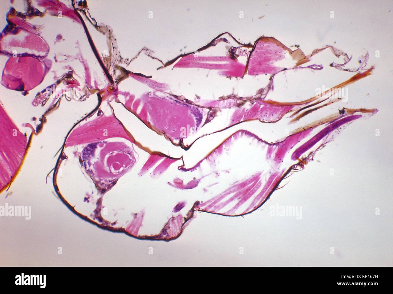 A photomicrograph revealing the histology of Onchocerca volvulus ...