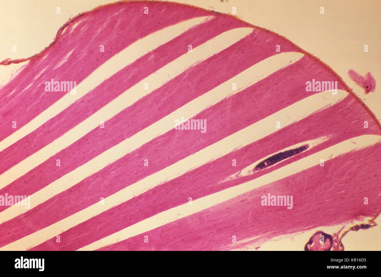 A photomicrograph revealing the histology of Onchocerca volvulus ...