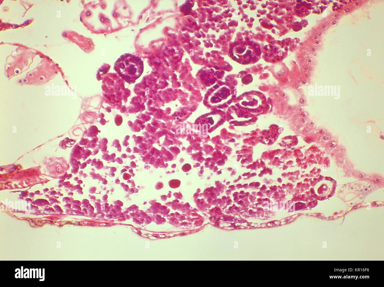 A photomicrograph revealing the histology of Onchocerca volvulus ...