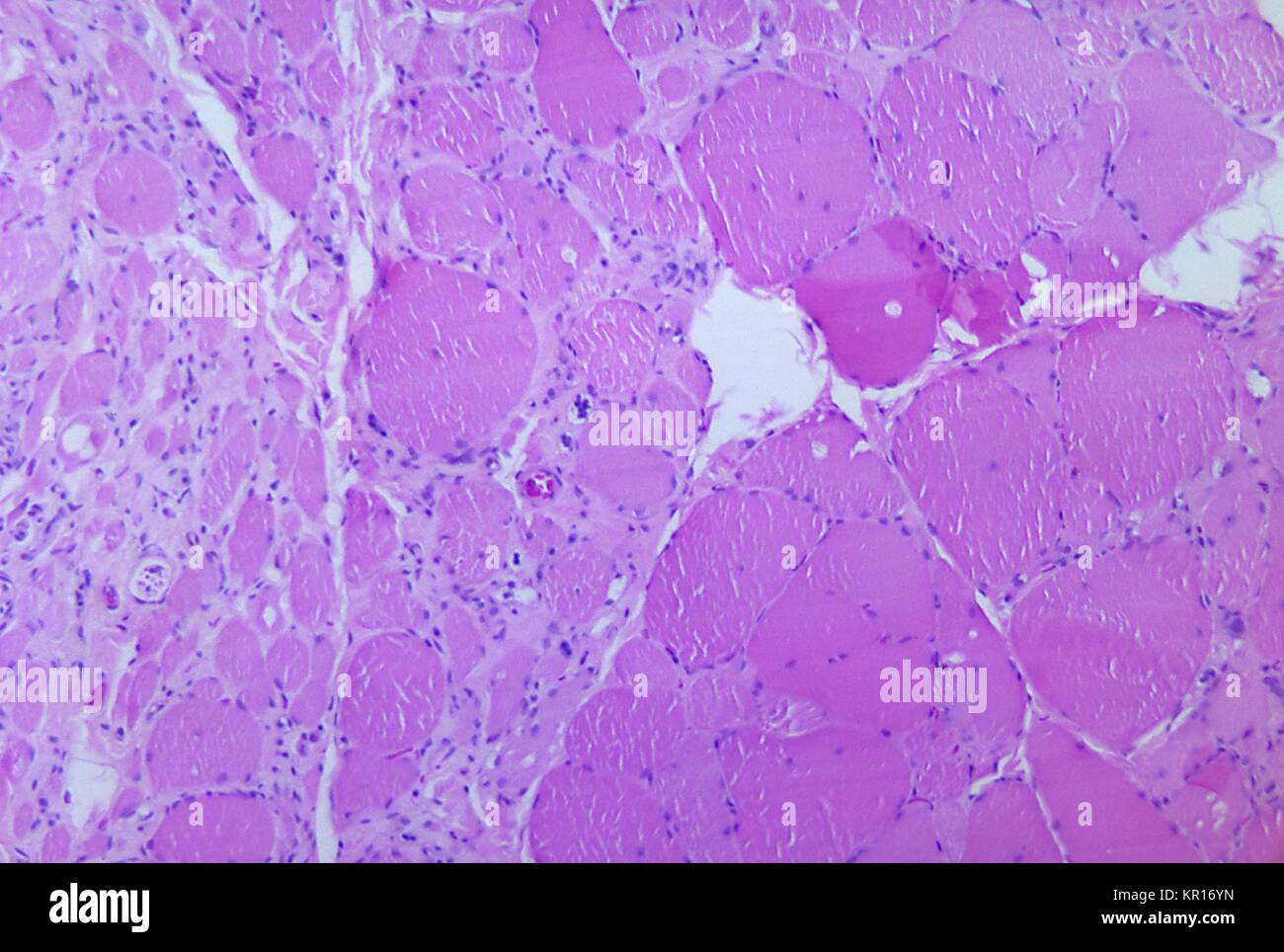 Skeletal muscle tissue hi-res stock photography and images - Alamy
