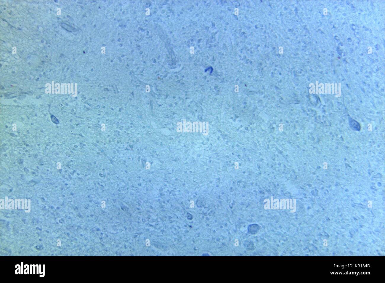 Cresyl violet stain hi-res stock photography and images - Alamy