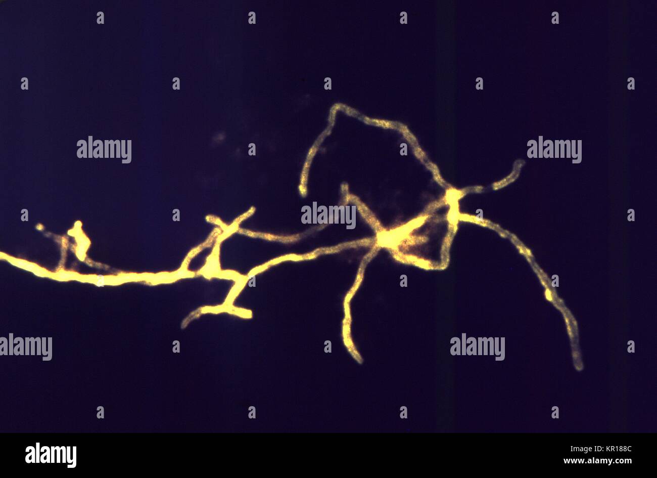 Actinomyces israelii hi-res stock photography and images - Alamy