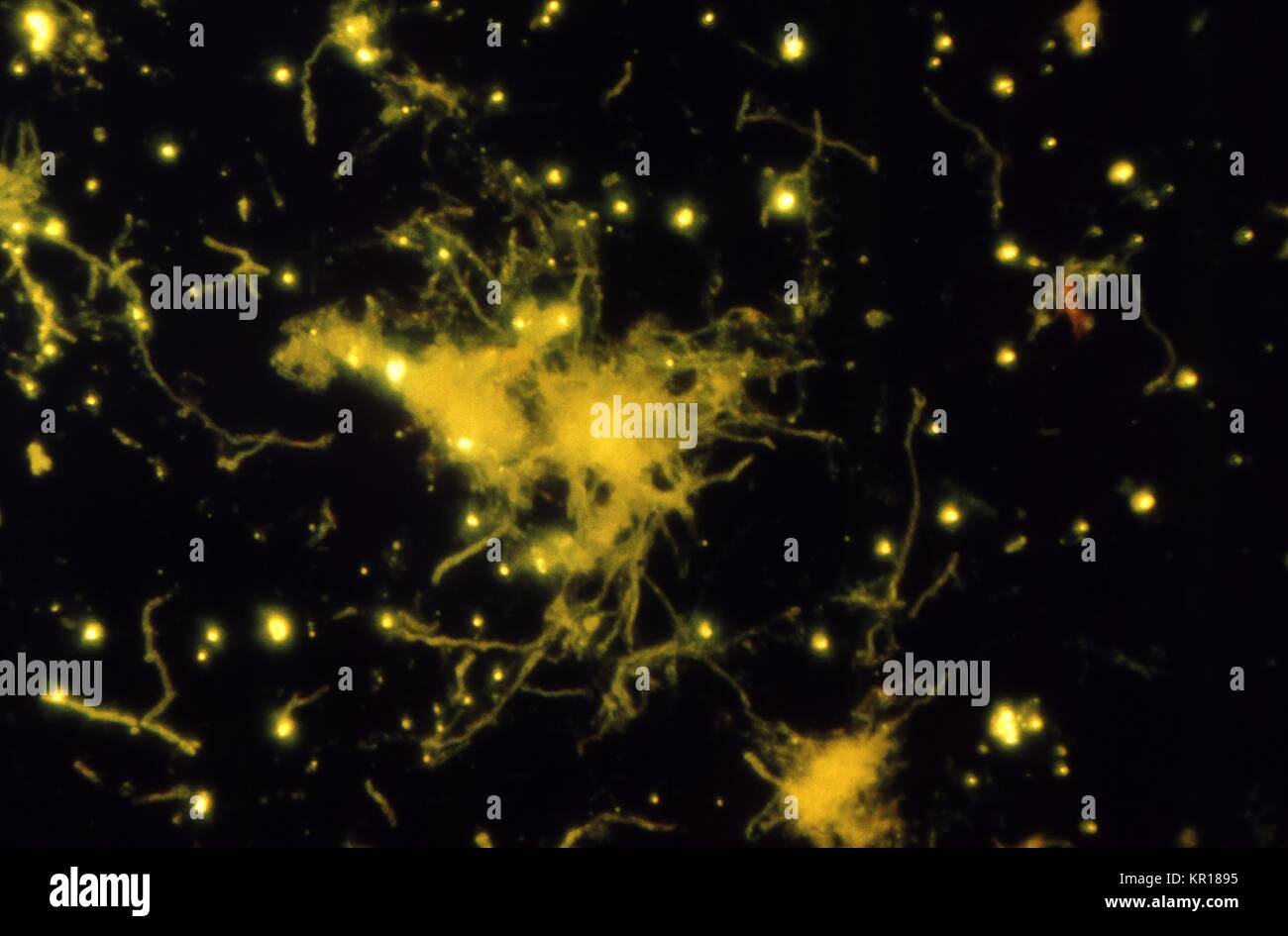 Magnified 500X, this photomicrograph reveals the presence of ...