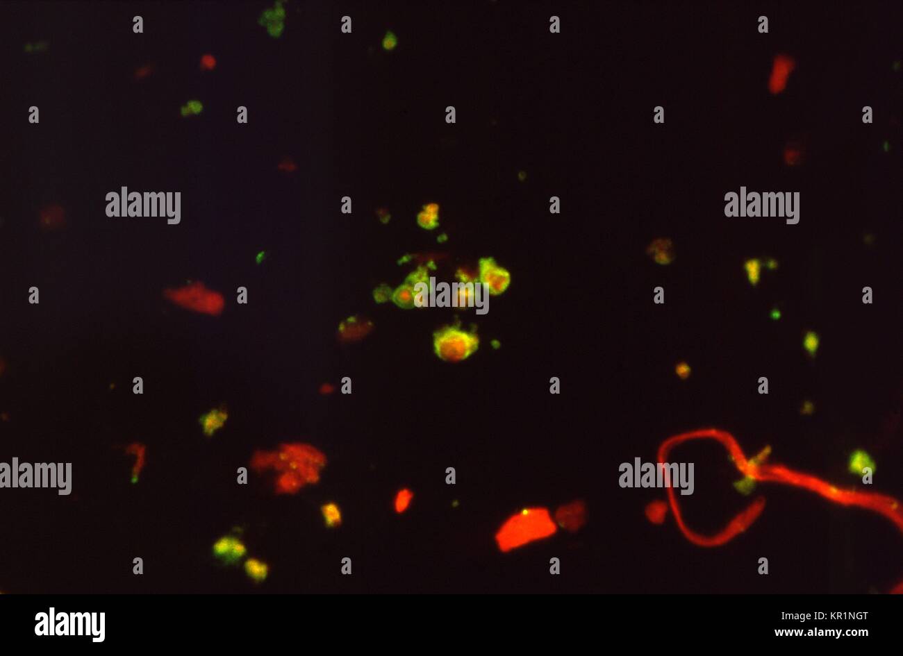 Under a magnification of 560X, this photomicrograph showing the ...