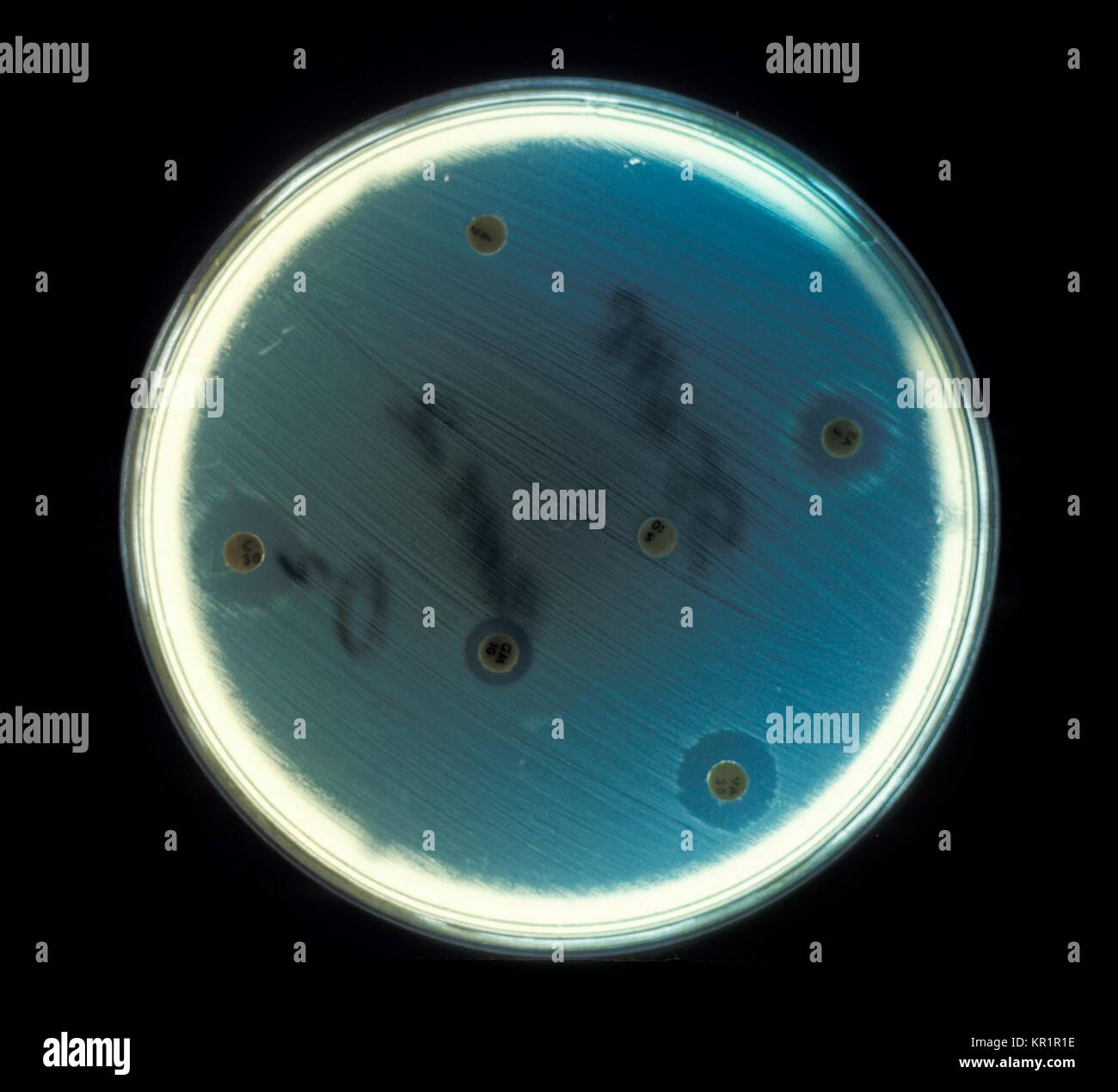 Enterococcus faecalis is shown cultured on an agar plate being tested ...