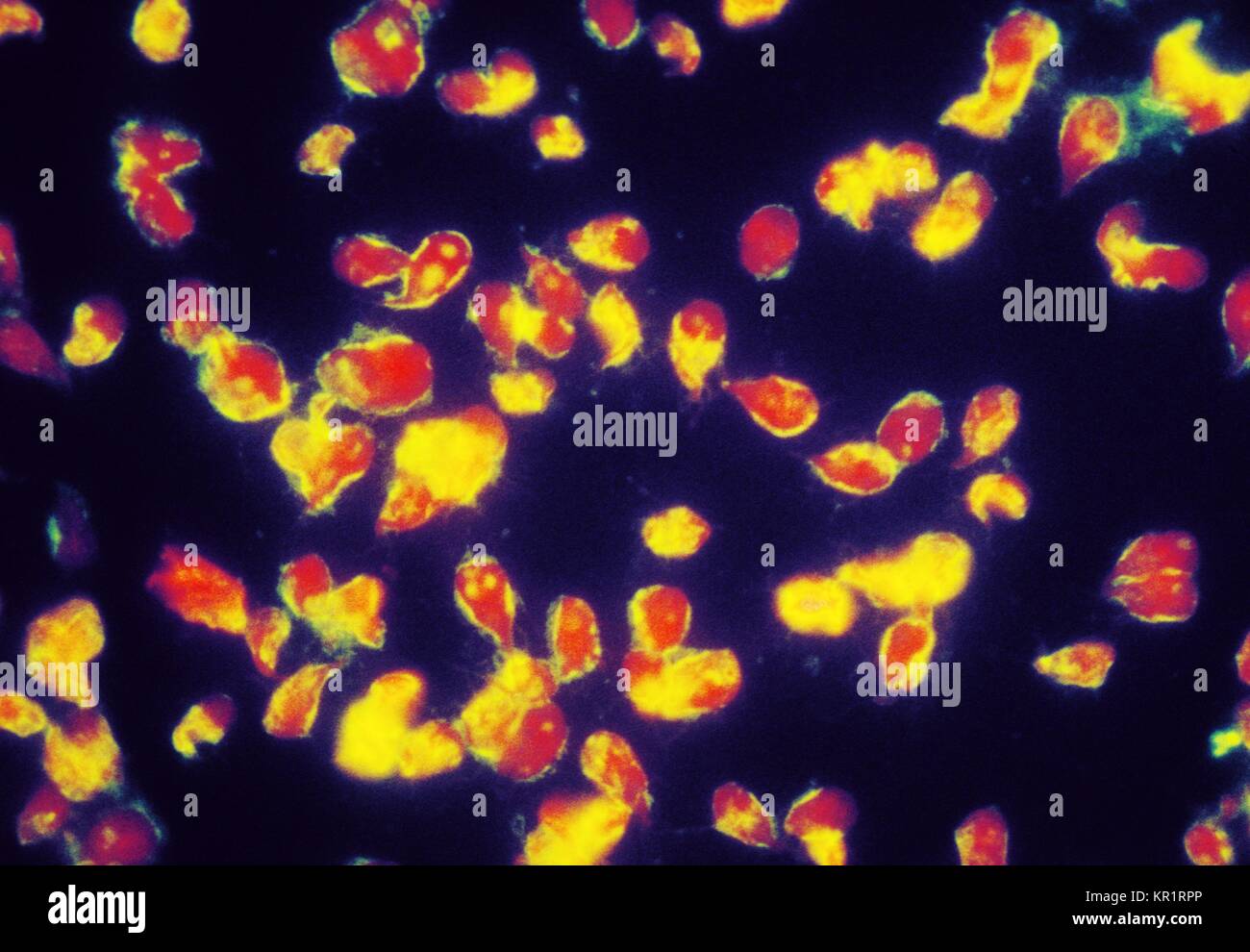 Giardiasis protozoan giardia lamblia hi-res stock photography and ...