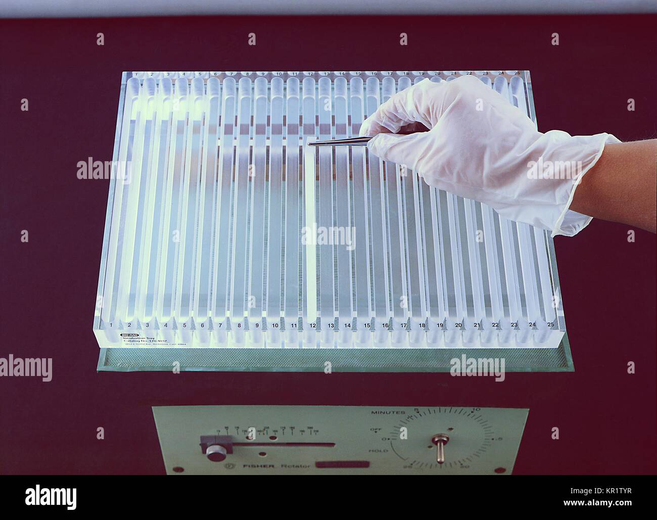 Western blot strip hi-res stock photography and images - Alamy