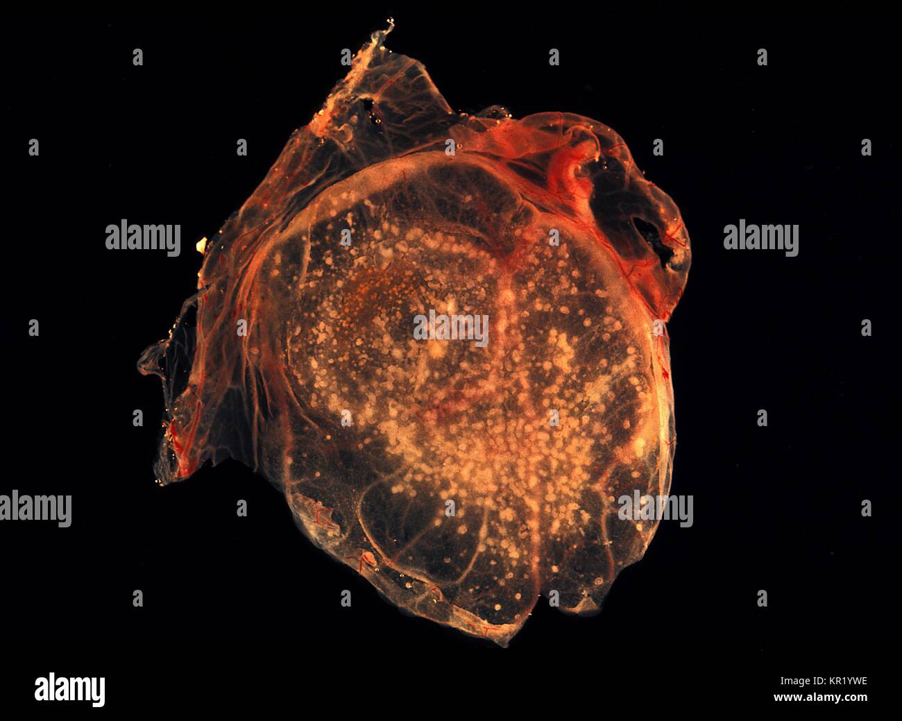 A photograph revealing smallpox virus pocks on the chorioallantoic ...