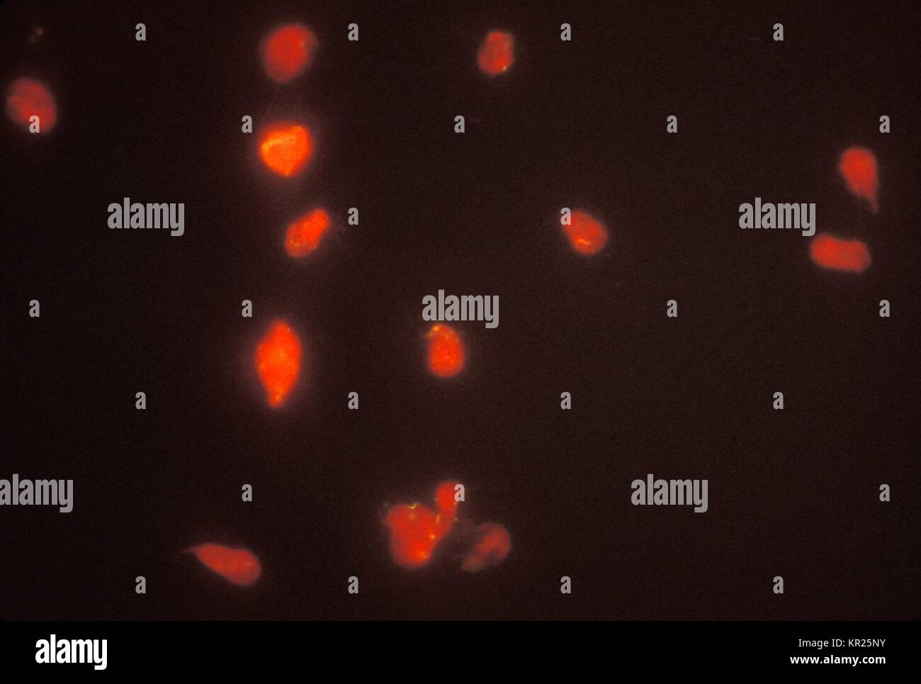 A photomicrograph of a positive indirect immunofluorescence test ...