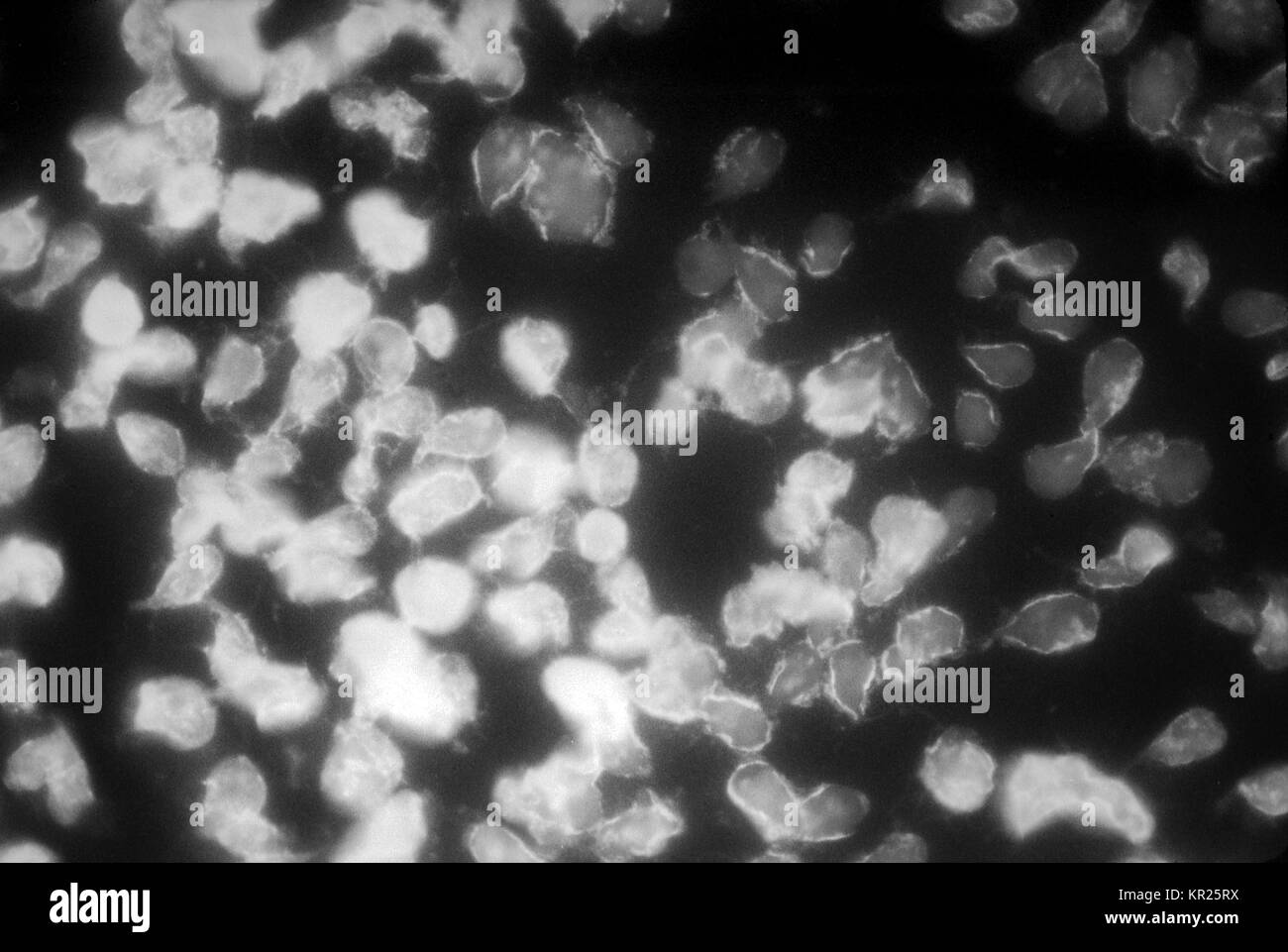Giardiasis protozoan giardia lamblia hi-res stock photography and ...