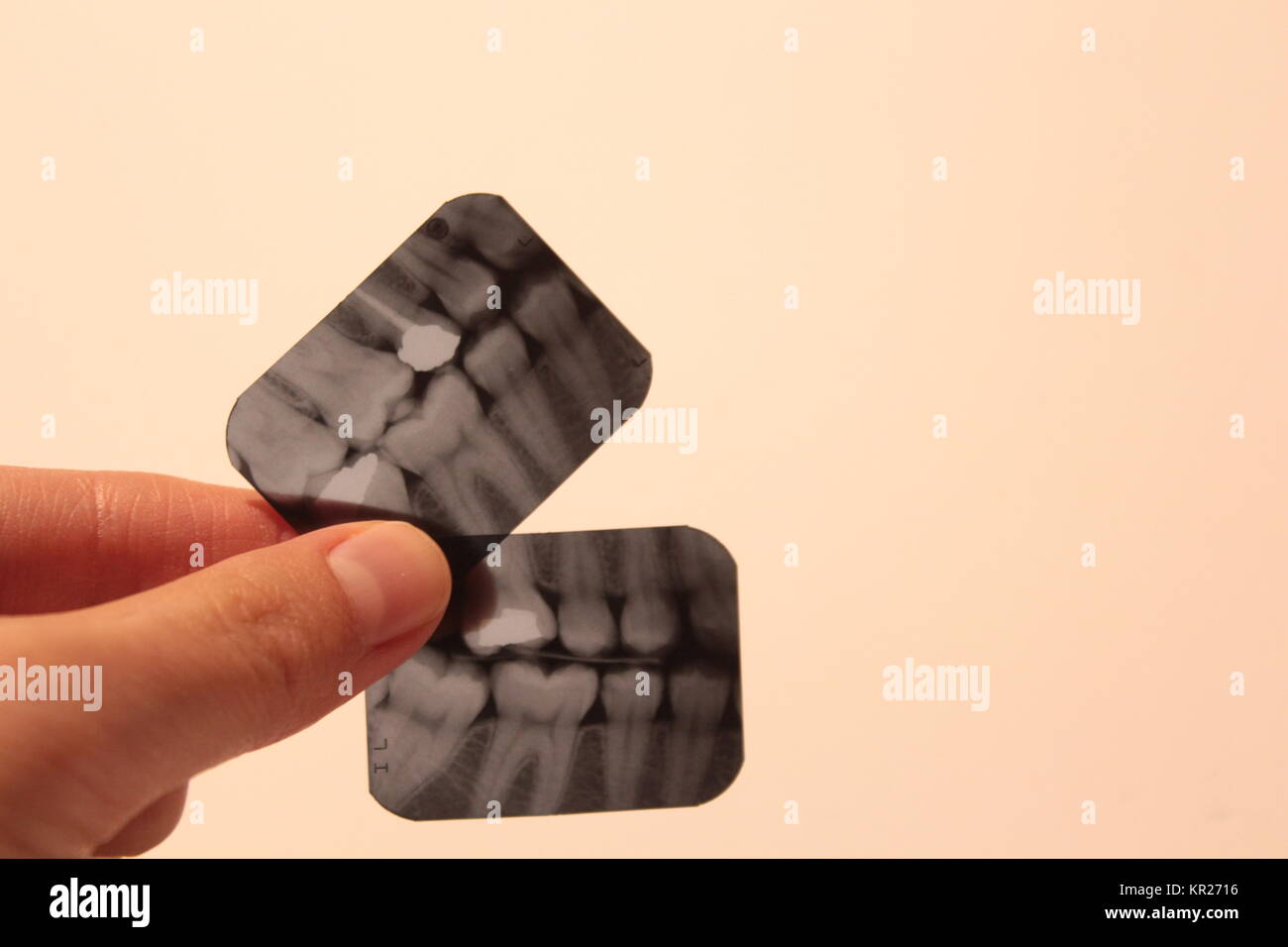 teeth radiology dentist Stock Photo - Alamy