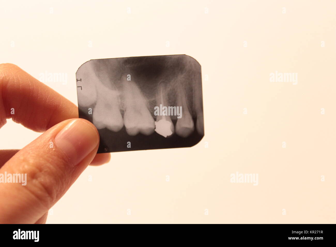 teeth radiology dentist Stock Photo - Alamy