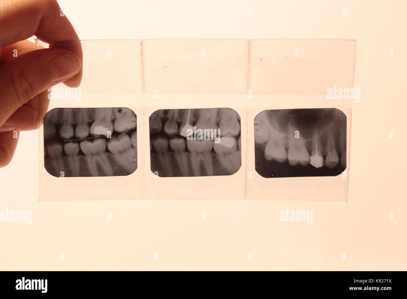 teeth radiology dentist Stock Photo - Alamy