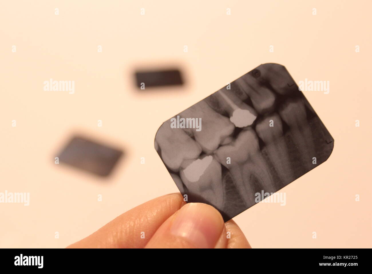 teeth radiology dentist Stock Photo - Alamy