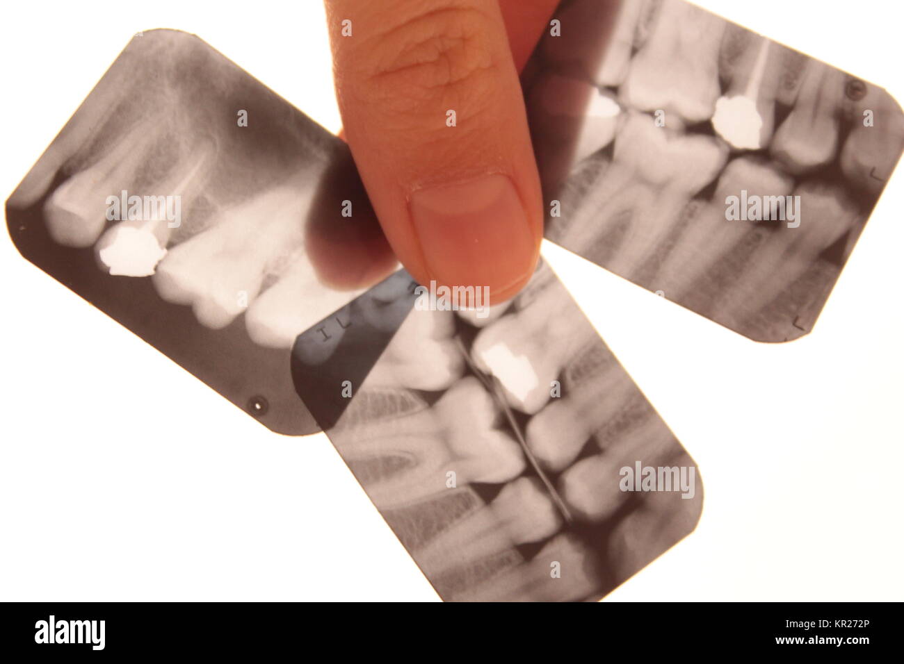 teeth radiology dentist Stock Photo - Alamy