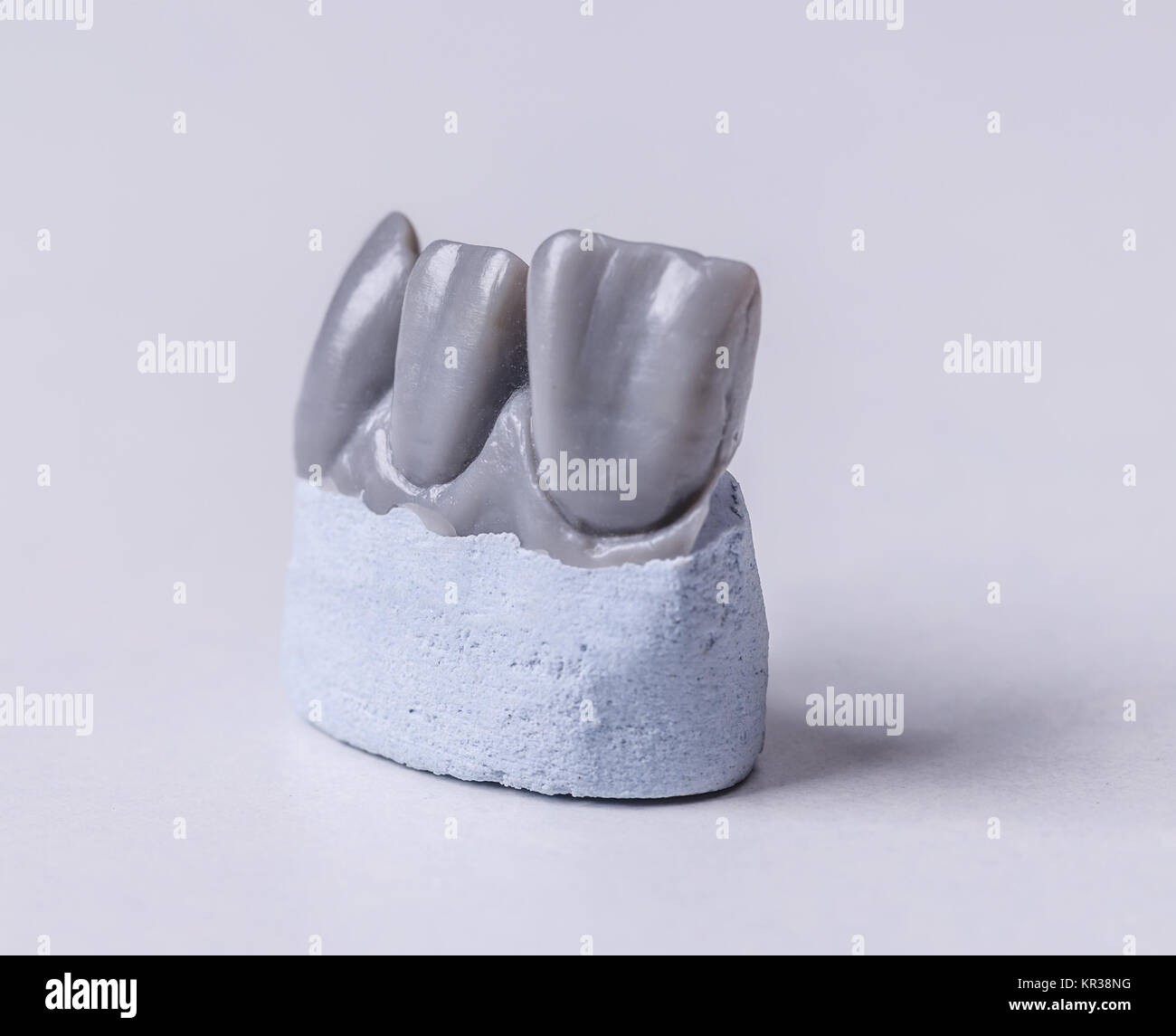 Artificial tooth crowns hi-res stock photography and images - Alamy