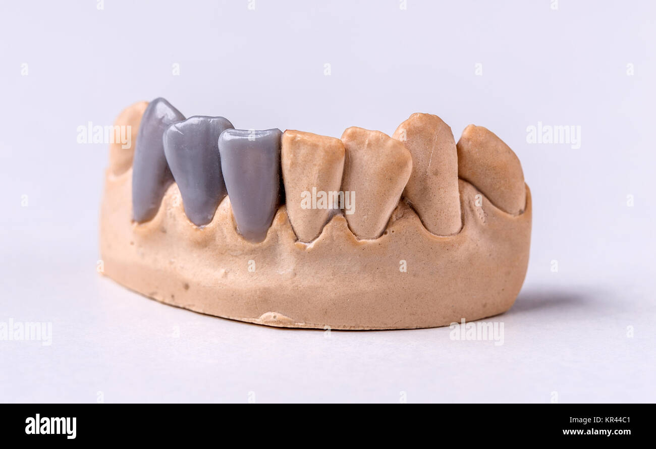 Wax teeth hi-res stock photography and images - Alamy