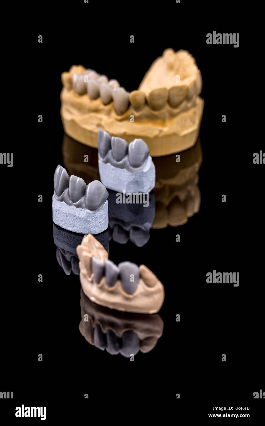 Porcelain false teeth hi-res stock photography and images - Alamy