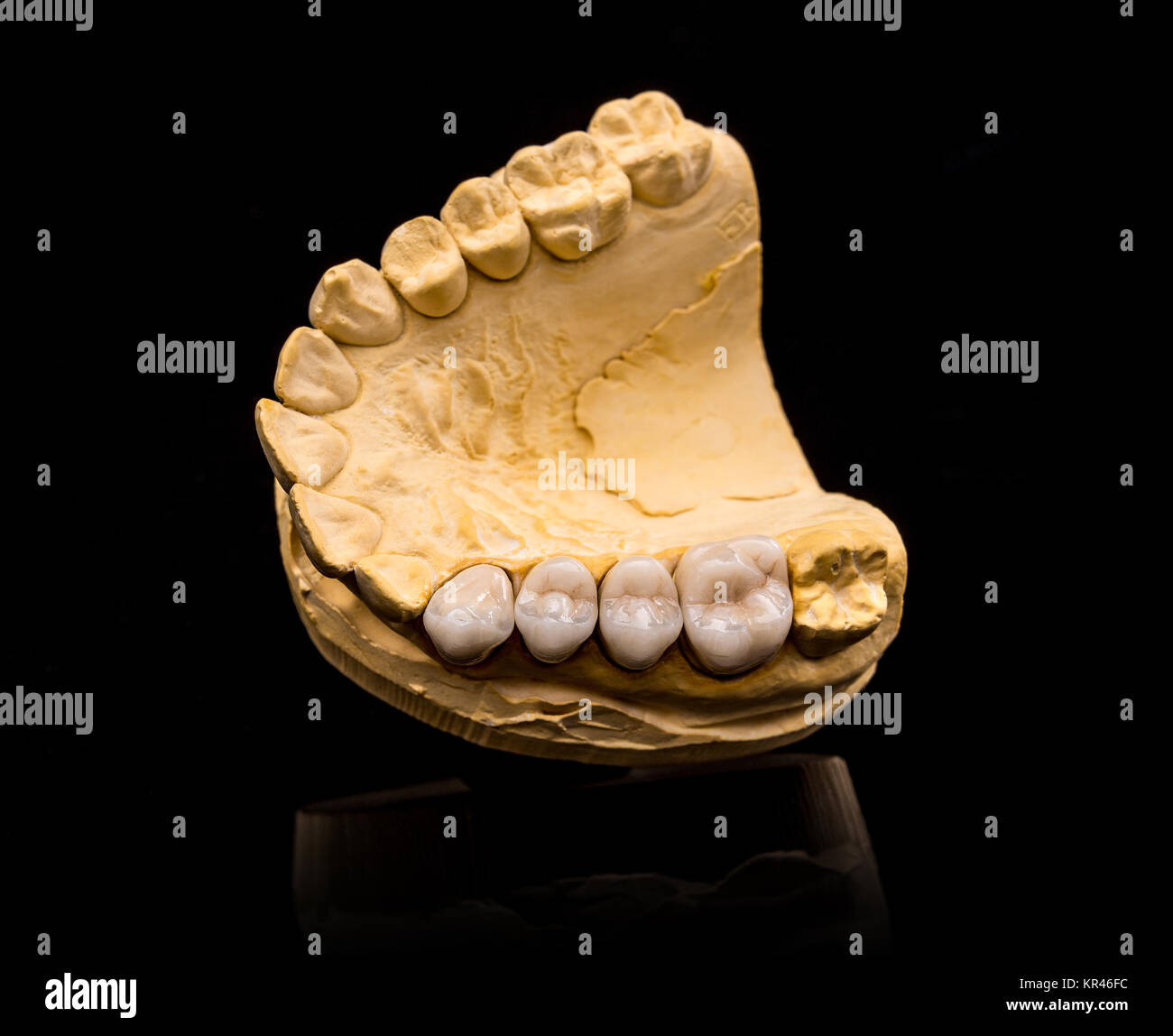 Artificial tooth manufacturing hi-res stock photography and images - Alamy