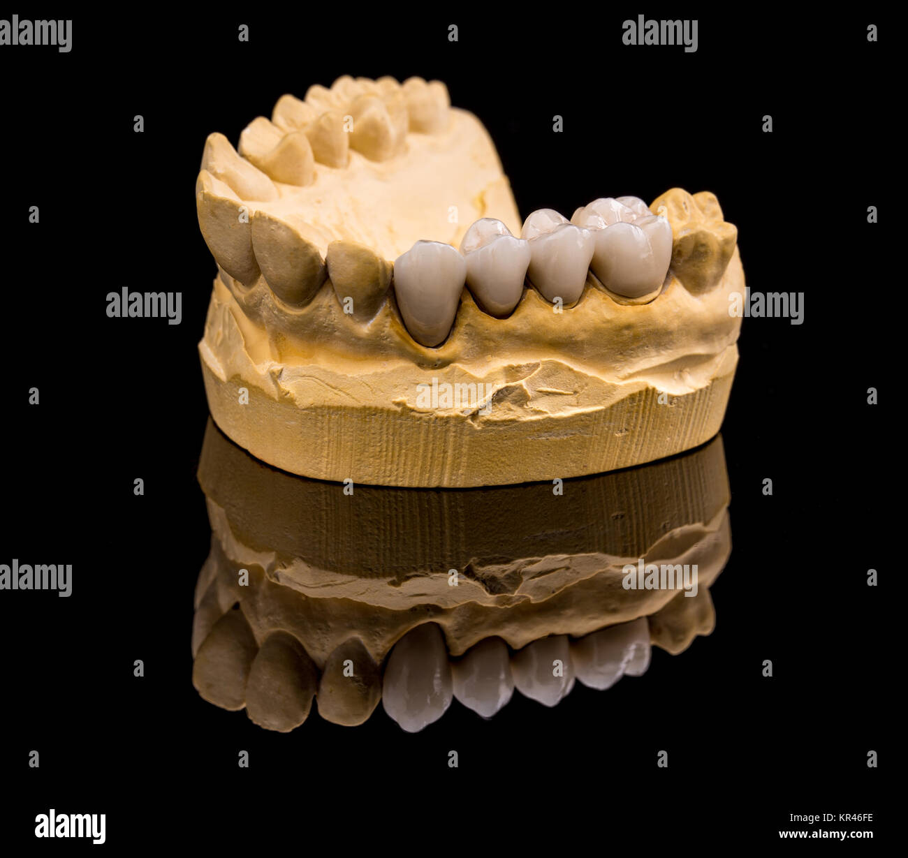 Ceramic prothesis implants hi-res stock photography and images - Alamy