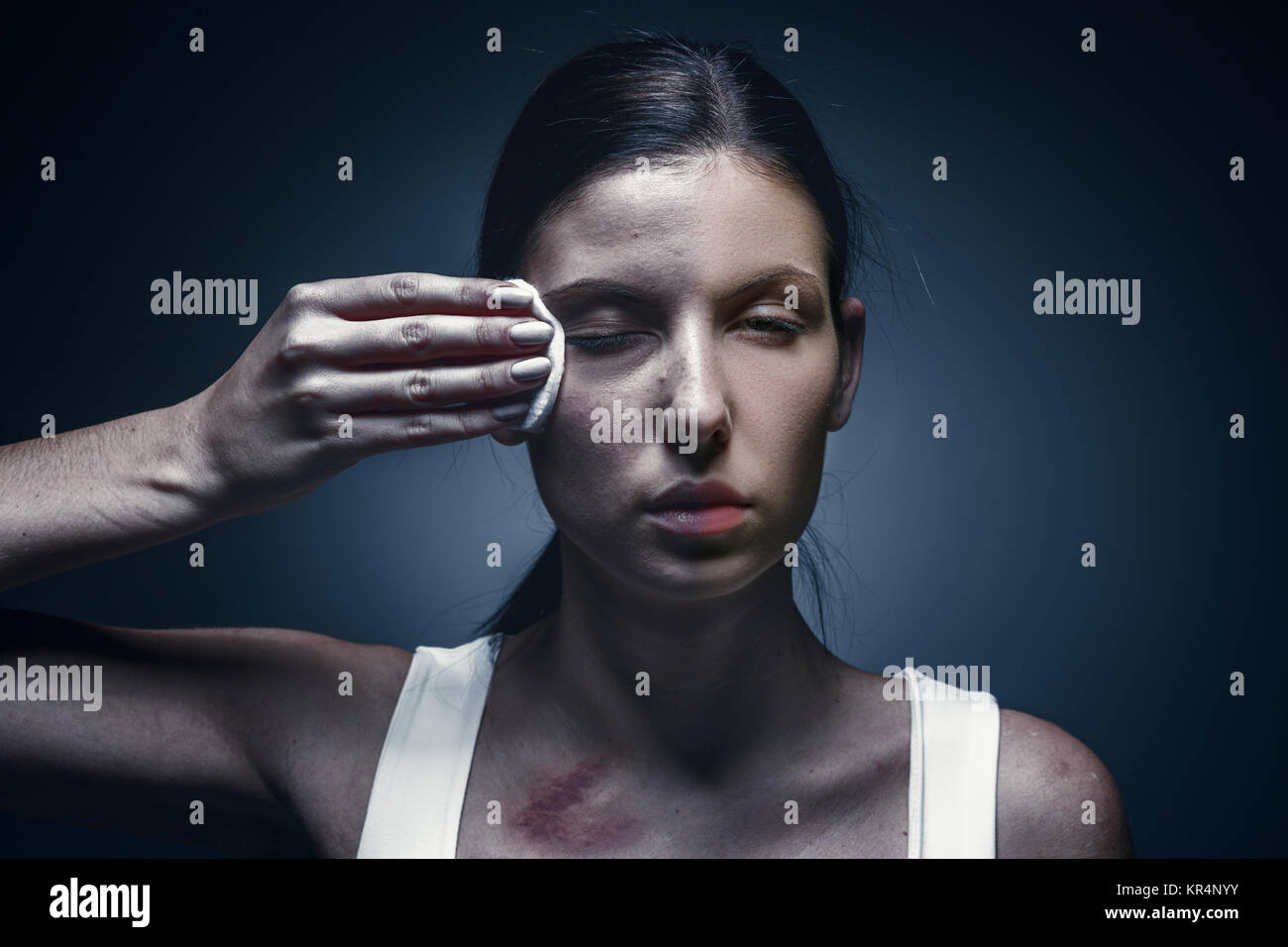 Close up portrait of a crying woman with bruised skin and black eyes ...