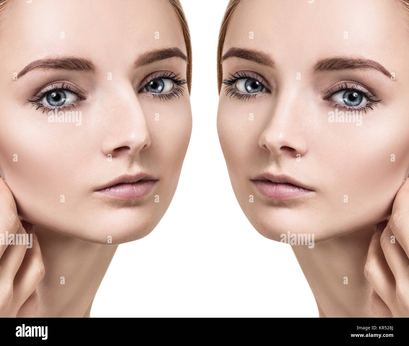 Female nose before and after cosmetic surgery Stock Photo - Alamy