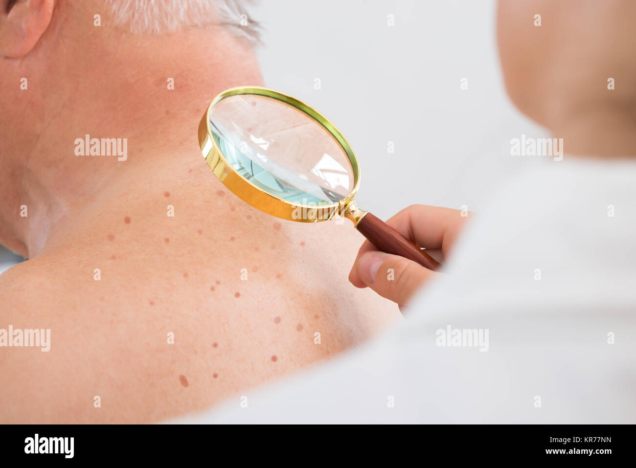 Doctor Checking Skin Of Patient With Magnifying Glass Stock Photo - Alamy