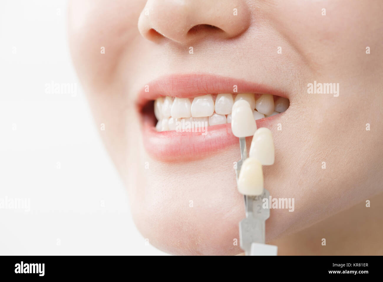 Young women tooth beauty Stock Photo - Alamy