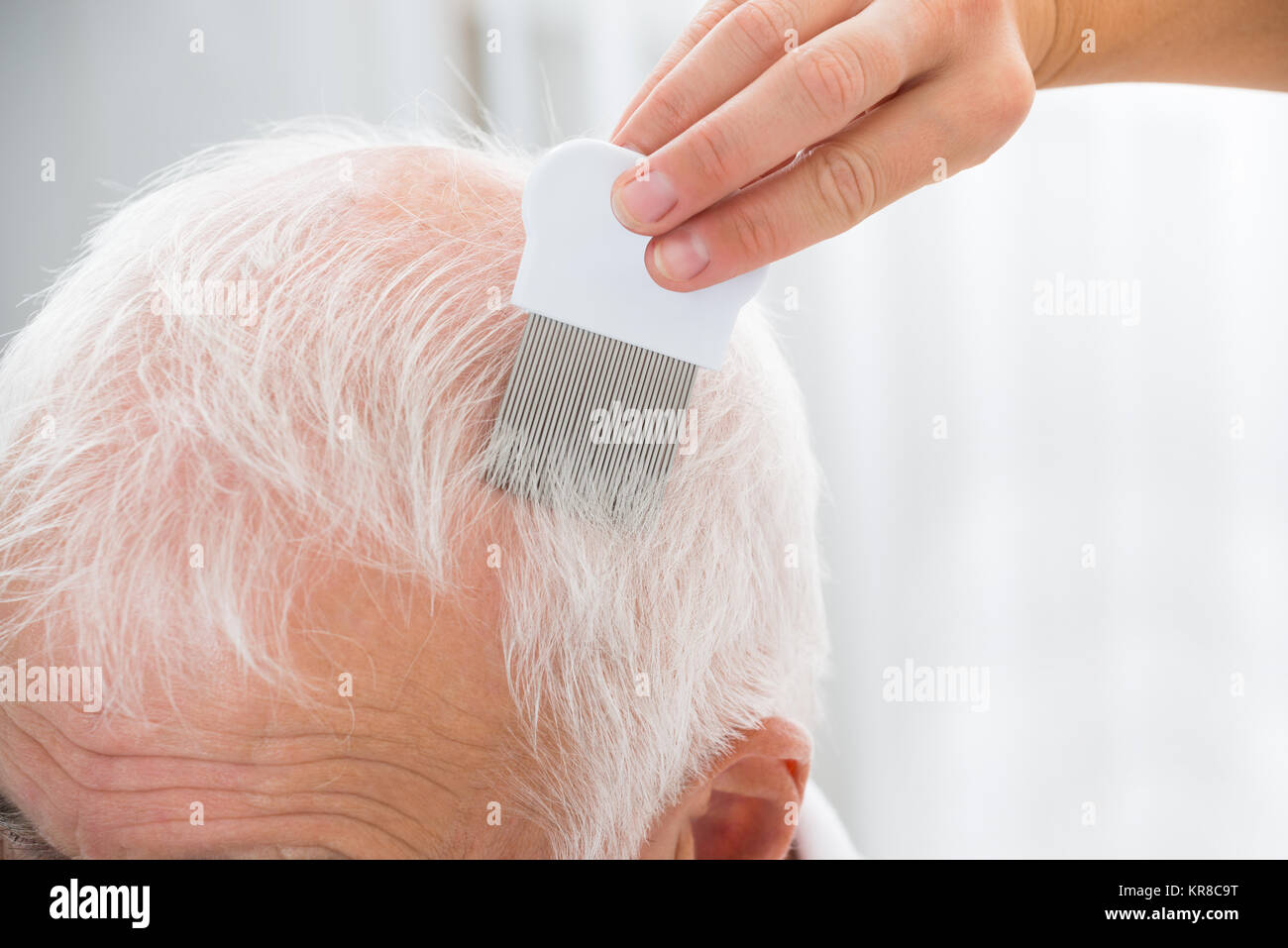 Doctor Doing Treatment On Patient's Hair With Comb Stock Photo - Alamy