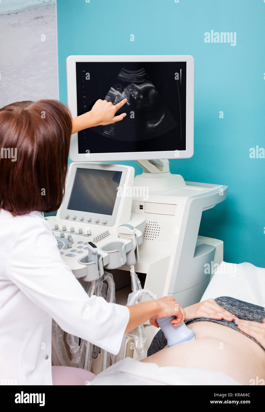 Sonographer pointing finger to specific point on sonogram of a fetus ...