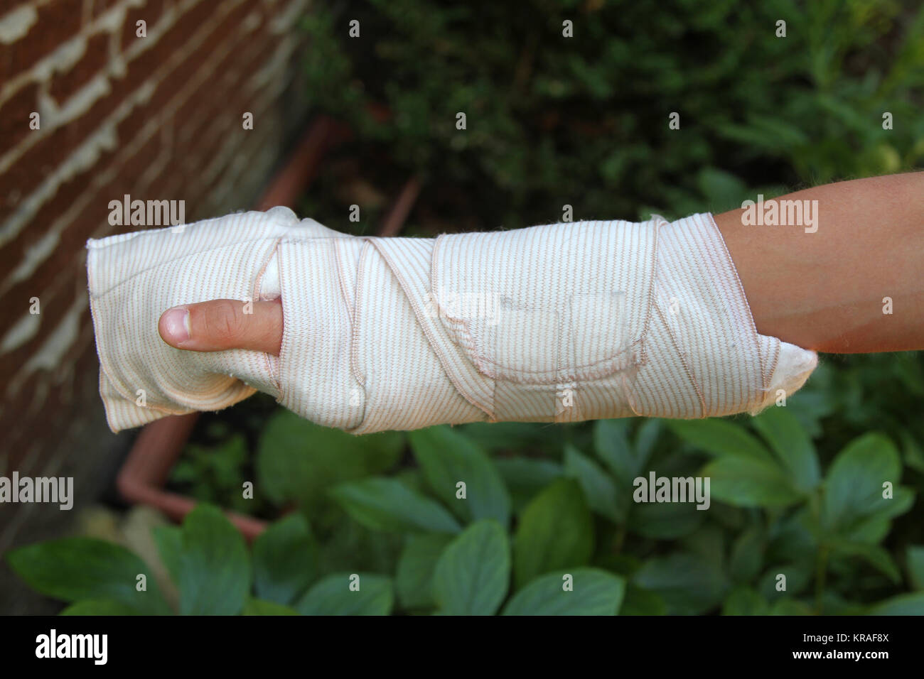 Arm wrapped up in a bandage Stock Photo - Alamy