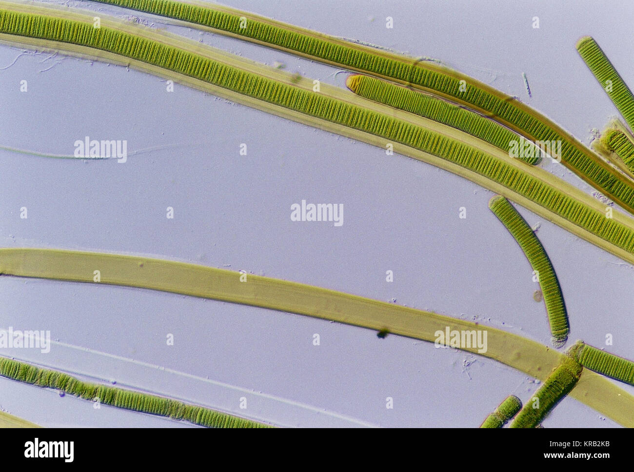 Lyngbya hi-res stock photography and images - Alamy