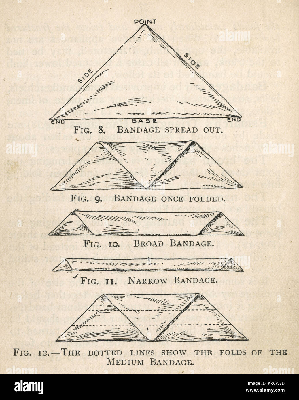 Diagram showing five stages in bandage folding Stock Photo - Alamy