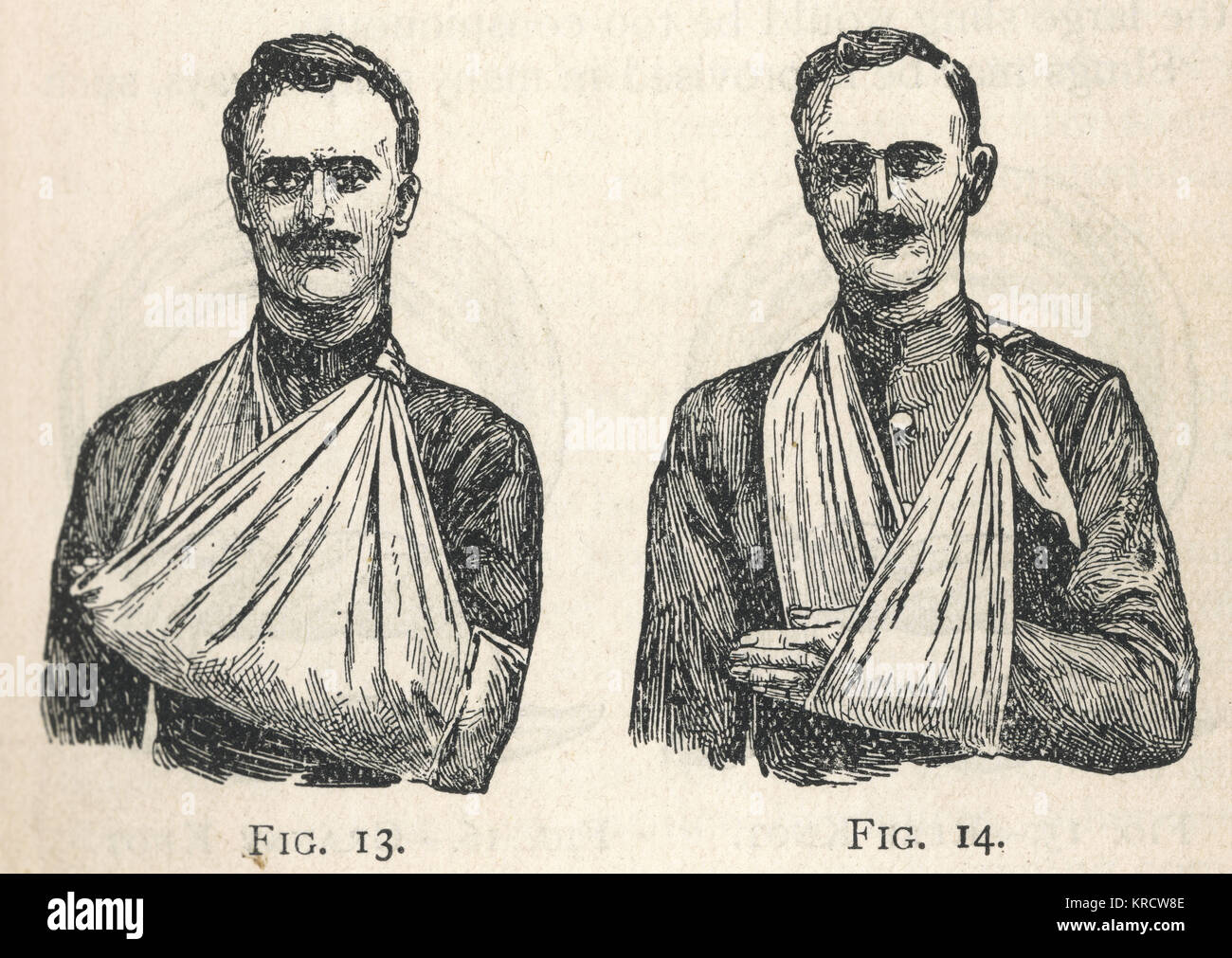 Arm slings hi-res stock photography and images - Alamy