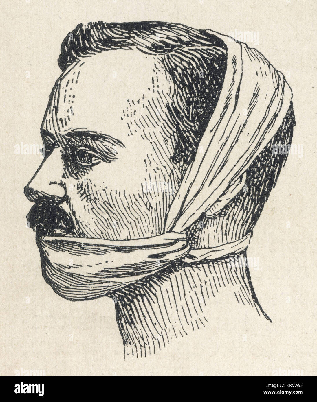 Bandage Head High Resolution Stock Photography and Images - Alamy