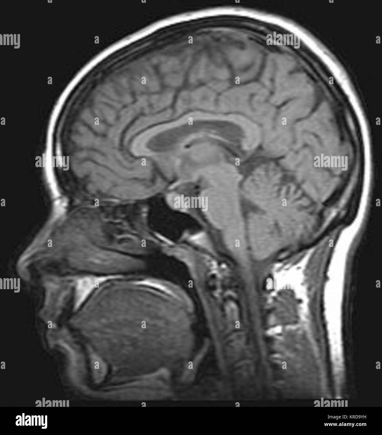 Brain scan research Black and White Stock Photos & Images - Alamy