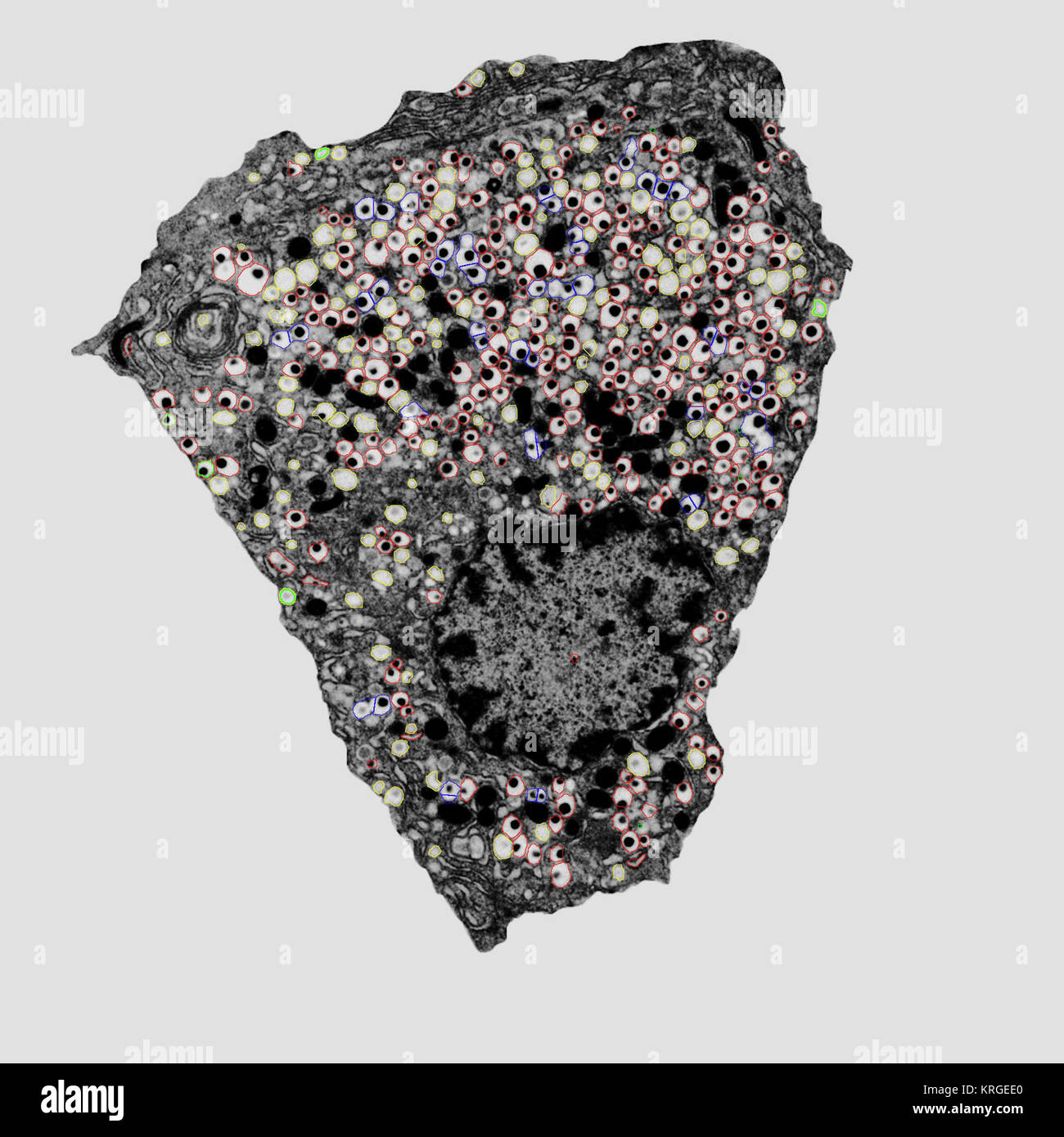 Beta cell processed Stock Photo - Alamy