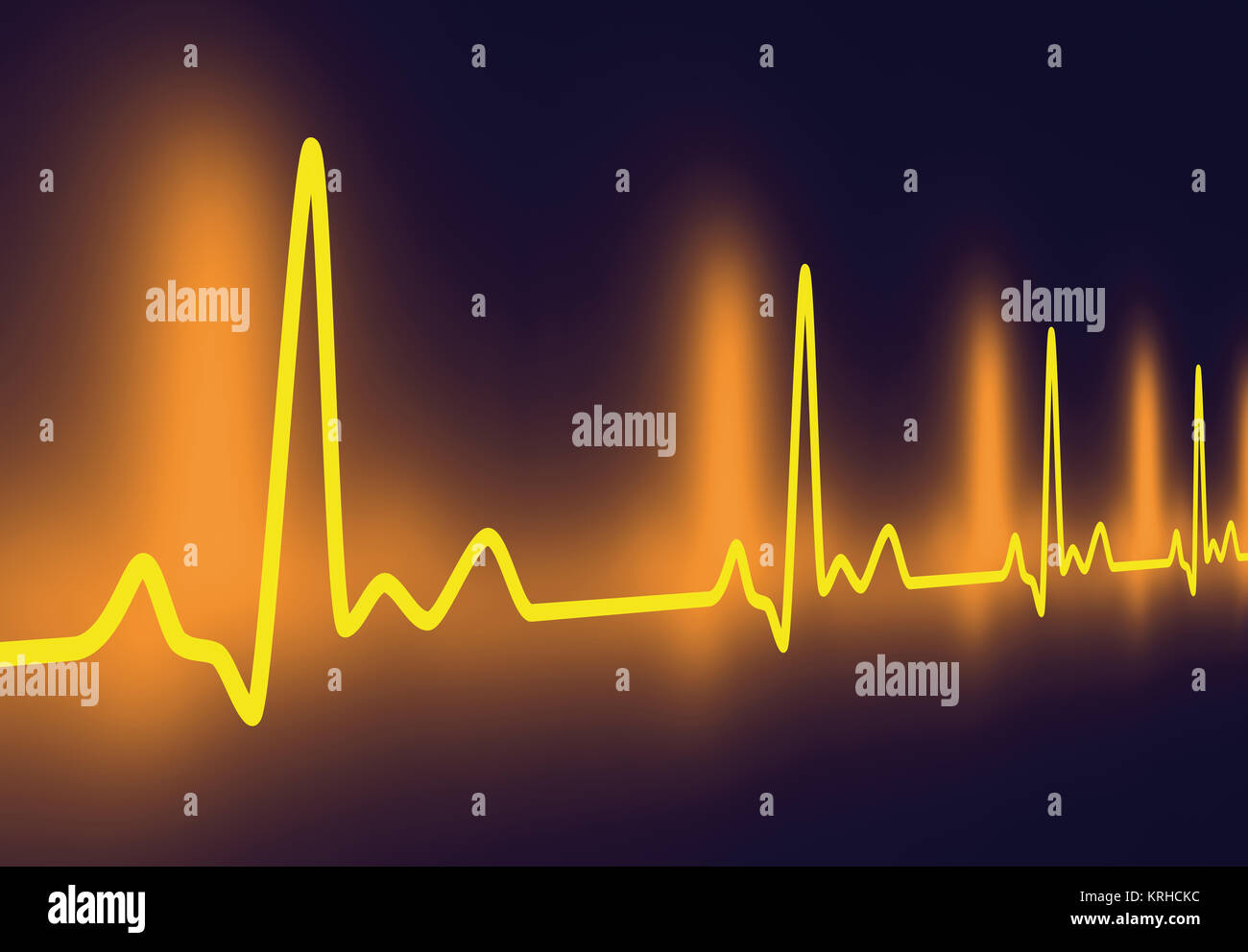 3D rendered Illustration. Heartbeat graph Stock Photo - Alamy