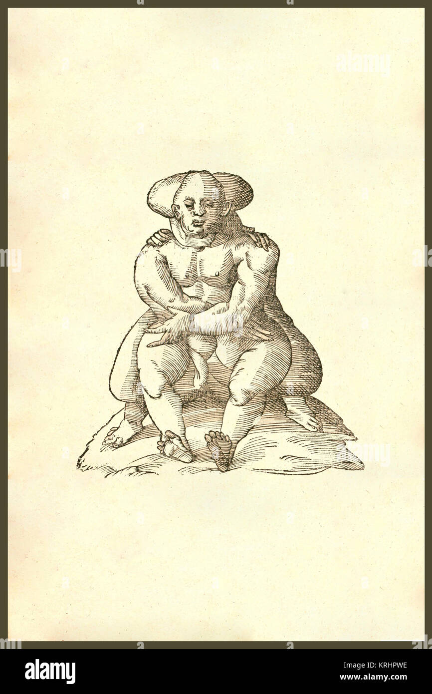 "Monstrum bisrons, monster with two bodies, siamese twins. From the ...