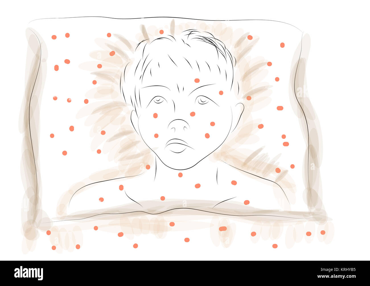 Measles virus illustration hi-res stock photography and images - Alamy