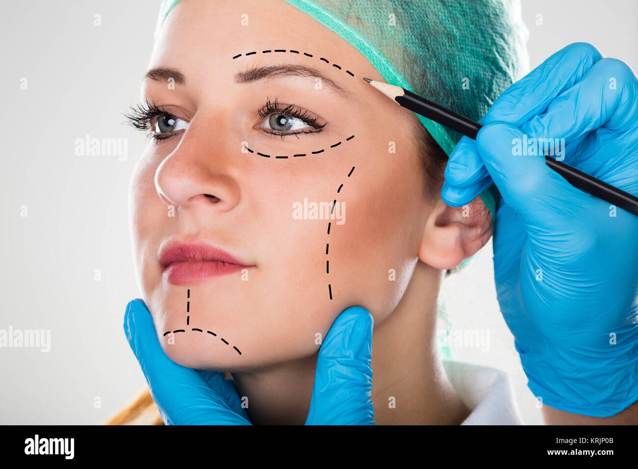 Surgeon Drawing Perforation Lines On Woman's Face Stock Photo - Alamy