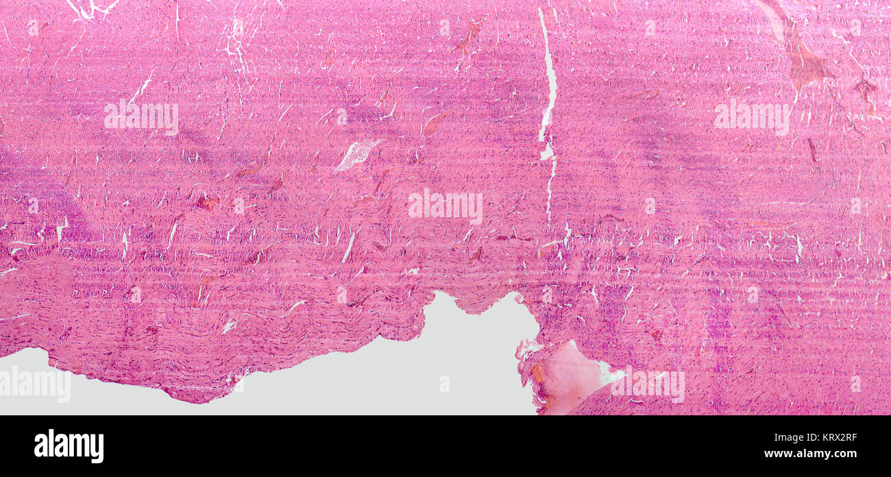 microscopic detail showing a rats heart detail Stock Photo - Alamy