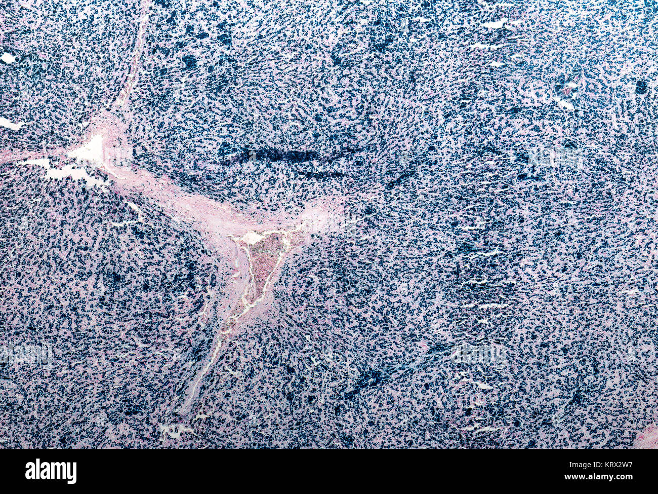 Human liver cross section hi-res stock photography and images - Alamy